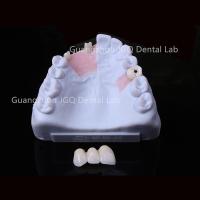 China Dental Zirconia Custom Abutment Lab Precise Esthetical As Strong As Titanium for sale