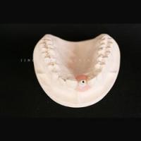 China Dental Zirconia Custom Abutment Lab Precise Esthetical As Strong As Titanium for sale