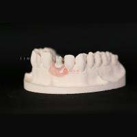 China Dental Implant Restorations Custom Titanium Zirconia Abutment En China Dental Lab for sale