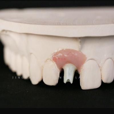 China Custom Dental Implant Screw Retained Crown Hybrid Dentures Zirconia Angled Abutment China Lab for sale