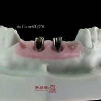 China Custom Milled Dental Implant Abutments in Titanium Zirconia FDA CE Certification for sale