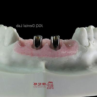 China Custom Milled Dental Implant Abutments in Titanium Zirconia FDA CE Certification for sale