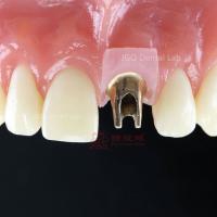 China Custom Milled Dental Implant Abutments in Titanium Zirconia FDA CE Certification for sale