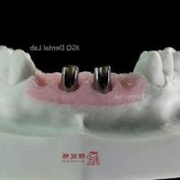 China Custom Milled Dental Implant Abutments in Titanium Zirconia FDA CE Certification for sale