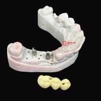 China Dental Implants Custom Titanium Abutment Corrosion Resistant FDA Certification for sale