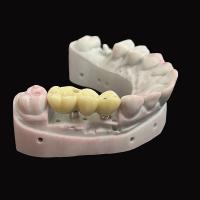 China Dental Implants Custom Titanium Abutment Corrosion Resistant FDA Certification for sale