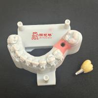 China Dental Implants Custom Titanium Abutment Corrosion Resistant FDA Certification for sale