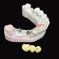 China Dental Implants Custom Titanium Abutment Corrosion Resistant FDA Certification for sale