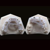 China Dental Lab Customized Surgical Guide For Dental Implants 3D Laser Printing for sale