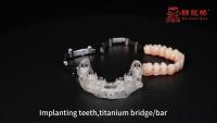 China Digital Tooth Supported Surgical Guide For Dental Implants 3D Printed for sale