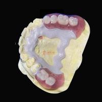 China 3D Printing Peek Frame Removable Dentures Acrylic Teeth China Dental Lab for sale