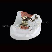 China 3D Printing Titanium Dental Framework for Customized Removable Dentures for sale
