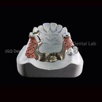 China 3D Printing Titanium Dental Framework for Customized Removable Dentures for sale