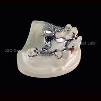 China 3D Printing Titanium Dental Framework for Customized Removable Dentures for sale