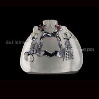 China 3D Printing Titanium Dental Framework for Customized Removable Dentures for sale