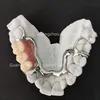 China Precise Fit Removable Dentures Metal Framework Customized for sale