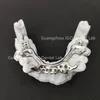 China Precise Fit Removable Dentures Metal Framework Customized for sale