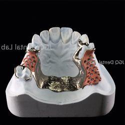 China Precise Fit Removable Dentures Metal Framework Customized for sale