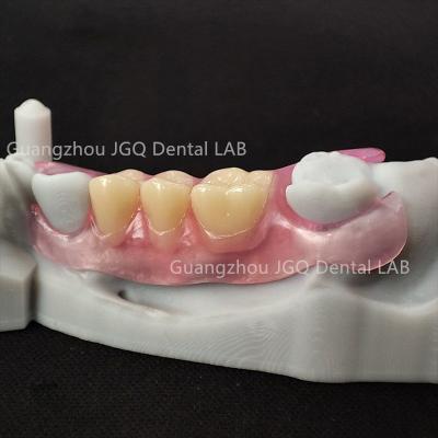 China Valplast Flexible Denture Unique Material Flexibility Comfort Adapting to Mouth for sale
