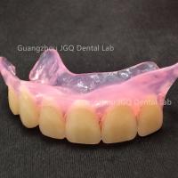 China Valplast Flexible Denture Unique Material Flexibility Comfort Adapting to Mouth for sale