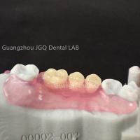 China Valplast Flexible Denture Unique Material Flexibility Comfort Adapting to Mouth for sale