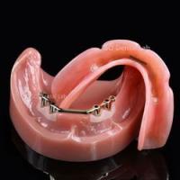 China Dental Zirconia Bridge Over Milled Titanium Bar High Accuracy Customizable for sale
