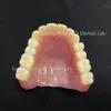 China China Dental Lab Digital Full Dentures Using CAD/Cam Technology 3D Printing and Skilled Technicians for sale