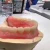 China China Dental Lab Digital Full Dentures Using CAD/Cam Technology 3D Printing and Skilled Technicians for sale