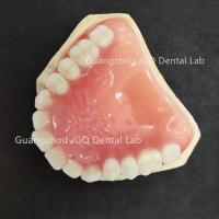 China Custom Acrylic Removable Dentures Natural Looking From China Dental Lab for sale
