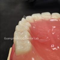 China Custom Acrylic Removable Dentures Natural Looking From China Dental Lab for sale
