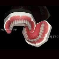 China Natural Looking Removable Partial Dentures Customized for Daily Functions for sale