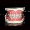 China Medical Grade Acrylic Material Removable Full Dentures Dental Lab for sale