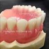 China Medical Grade Acrylic Material Removable Full Dentures Dental Lab for sale