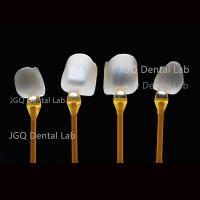 China High Translucency Cast Porcelain Emax Veneers China Dental Lab OEM for sale