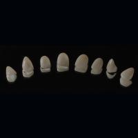 China High Translucency Cast Porcelain Emax Veneers China Dental Lab OEM for sale