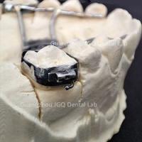 China 3D Printing Minimal Prep Orthodontic Arch Expander For Teenager for sale