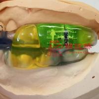 China Dental Orthodontic Appliance Lab Denture Shark Anti Snoring Guard for Children Adults for sale