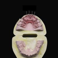 China Customized Orthodontic Dental Retainer 3D Laser Printing CE/FDA Certified for sale