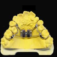 China Customized Dental Orthodontic Appliances Arch Expansion Expander Device for sale