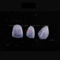 China Tooth Like Shells Dental Porcelain Emax Veneers Dsd Design China Dental Lab for sale