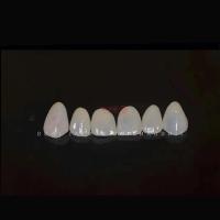 China Tooth Like Shells Dental Porcelain Emax Veneers Dsd Design China Dental Lab for sale