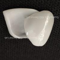 China Tooth Like Shells Dental Porcelain Emax Veneers Dsd Design China Dental Lab for sale