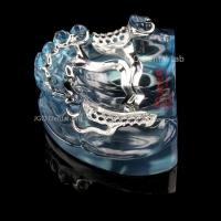 China 3D Laser Printing Removable Dentures Customized with Co-Cr Alloy Framework for sale