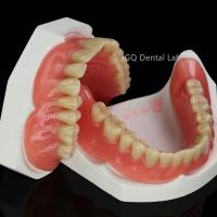 China 3D Laser Printing Removable Dentures Customized with Co-Cr Alloy Framework for sale