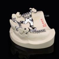 China 3D Laser Printing Removable Dentures Customized with Co-Cr Alloy Framework for sale
