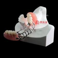 China 3D Laser Printing Removable Dentures Customized with Co-Cr Alloy Framework for sale
