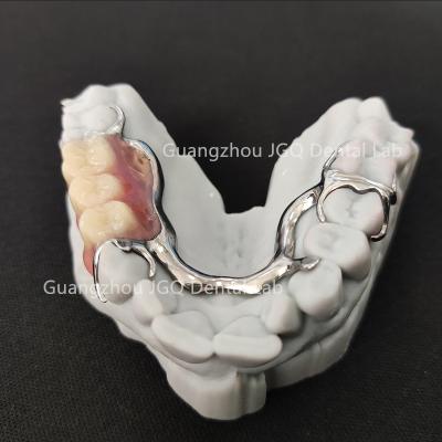 China Lightweight Dental Framework Partial Dentures 3D Laser Printing Comfortable for sale