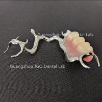 China Lightweight Dental Framework Partial Dentures 3D Laser Printing Comfortable for sale