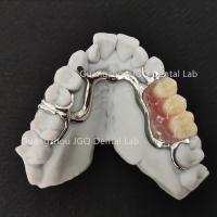 China Lightweight Dental Framework Partial Dentures 3D Laser Printing Comfortable for sale
