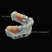 China Durable Metal Framework Dentures Removable 3D Printing Process for sale